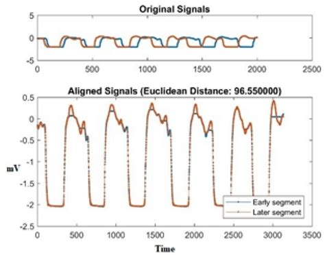 Use Of Dtw To Align Two Time Warped Segments Early And Later For Pd