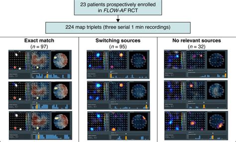 Electrographic Flow Mapping Of Persistent Atrial Fibrillation Intra And Inter Procedure