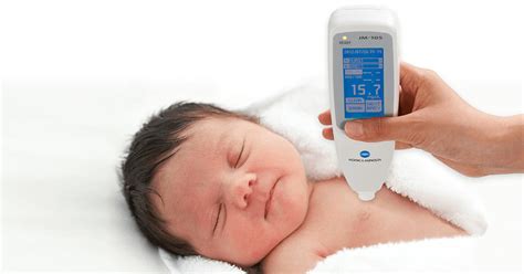 Transcutaneous Bilirubinometer
