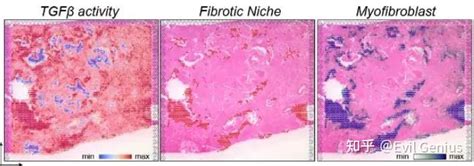 空间转录组分析之细胞niche（python）版本 知乎
