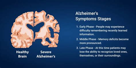 Alzheimers Disease Symptoms Early Signs Of Alzheimer Disease