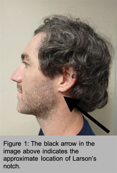 Em3am Laryngospasm Emdocs