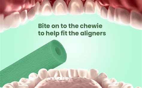 Toothsi Chewie Aligner Mint Flavored Aligner Tray Seaters 2cm