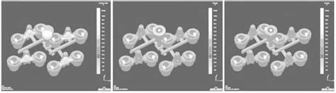 Optimization Of Casting Process For Ductile Iron Casting Of High Pressure Cylinder End Cap Zhy
