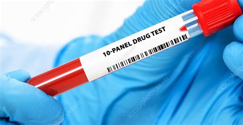 10 Panel Drug Test Stock Image F0445572 Science Photo Library