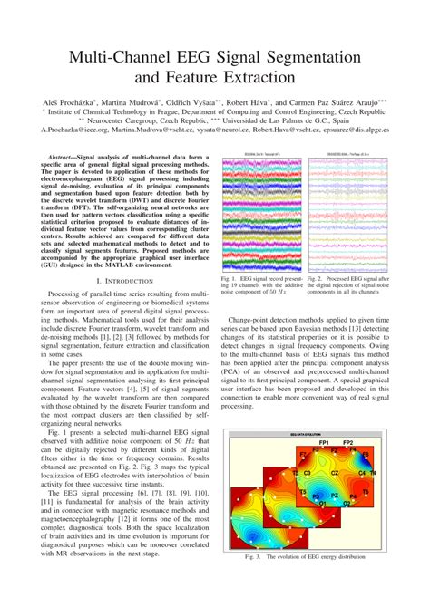PDF Multi Channel EEG Signal Segmentation And Feature Extraction