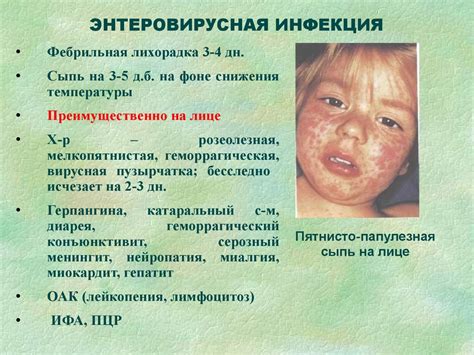 Дифференциальный диагноз заболеваний сопровождающихся синдромом экзантемы презентация онлайн