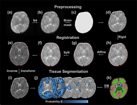 Preprocesing Steps And Atlas Based Brain Tissue Segmentation A Raw Download Scientific