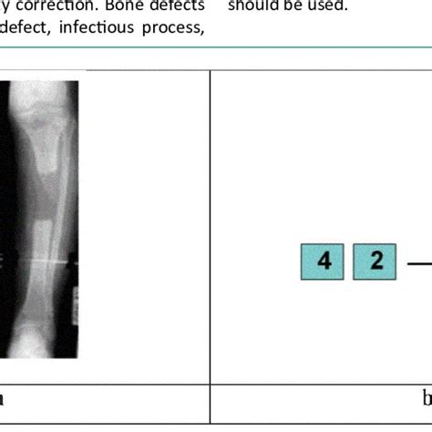 Pdf Long Bone Defect Classification What It Should Be