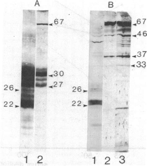 Western Blot Analysis Of Hbsag Recombinant Particles Recombinant