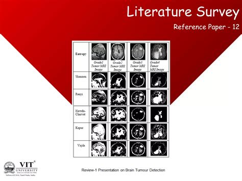 Brain Tumor Detection By Scanning Mri Images Using Filtering
