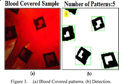 Figure 1 From Patterns Detection And Recognition In Visual Aided System For Prosthesis Pose