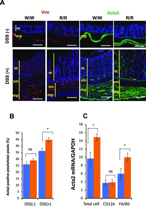 Myofibroblast Differentiation Is Facilitated In Rr Colon A
