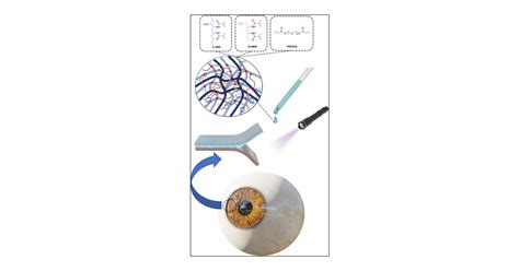 Rapidly Photocurable Corneal Interlamellar Adhesive For Deep Anterior