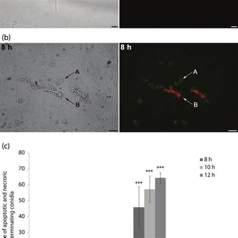 H 2 Dcfda Staining Of A Untransformed B Untransformed In The Download Scientific Diagram