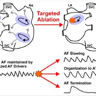 Defining Atrial Fibrillation Af Drivers Af Drivers Are Defined As