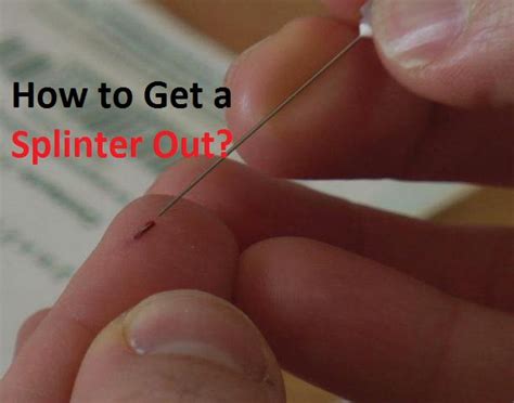How To Get A Splinter Out