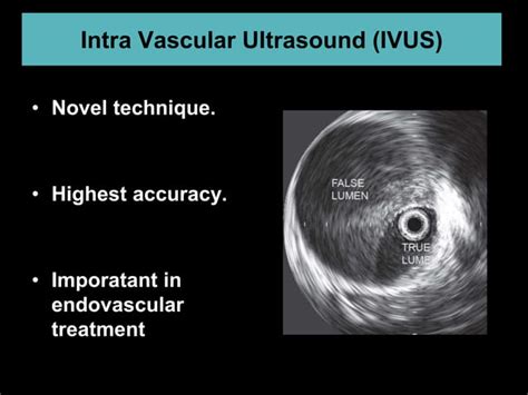 Type B Aortic Dissection Pptx