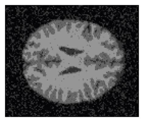 The Segmentation Results On Brain Image A Ground Truth B Raw