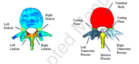 Partitioning Of A Vertebra Into Four Substructures Download Scientific Diagram