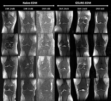 Figure 3 From Enhancing Deep Learning Driven Multi Coil Mri Reconstruction Via Self Supervised