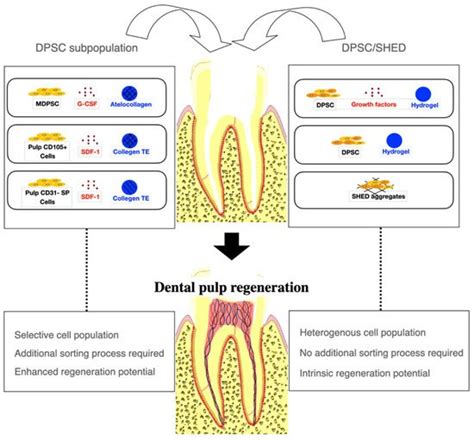 Dental Pulp Regeneration Encyclopedia Mdpi