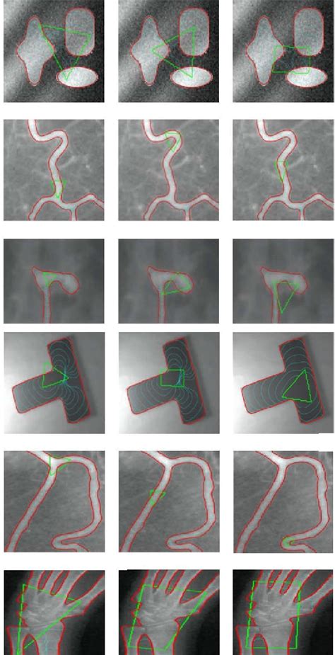 Figure 5 From An Active Contour Model Based On Local Pre Piecewise