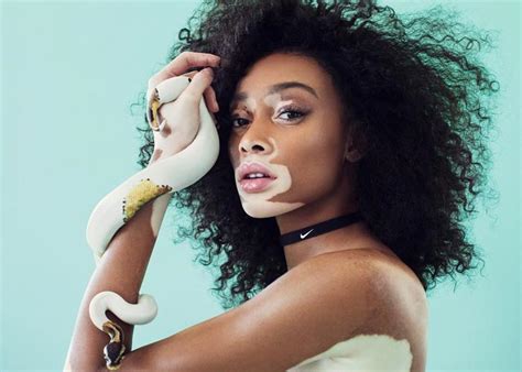 Всемирный день витилиго