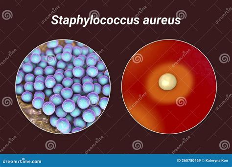 Bacteria Staphylococcus Aureus 3d Illustration Stock Illustration Illustration Of Microscope
