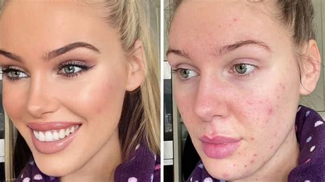 Glamour Filter Before And After At Alexis Hoff Blog