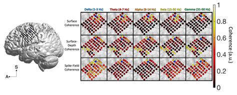 Frontocentral Cortical Coherence The Spatial Spread Of Surface Download Scientific Diagram