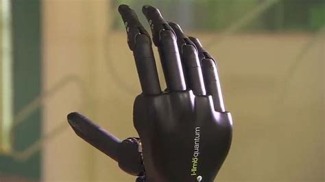 i limb bionic hand