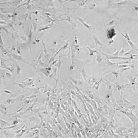 Morphology Transformation During Hipsc Msc Induction A Download Scientific Diagram