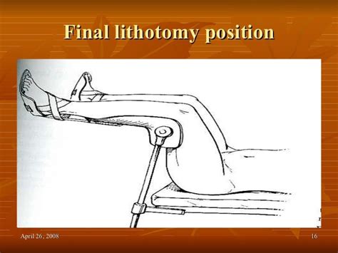 Patient Positioning