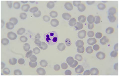 Intellectual Ventures Malaria Hunting Microscope Is Ready For Prime Time