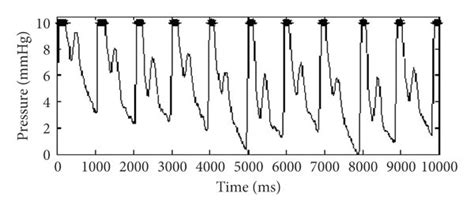 The Result Of Saturation Detection Of Pulse Signals In Figure 1