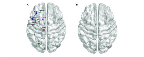 Structural Connectivity Sc Differences A The Structural Download Scientific Diagram