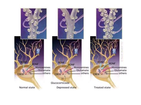 Neurobiology And Functional Brain Circuits In Mood Disorders Pptx Brain And Nervous System