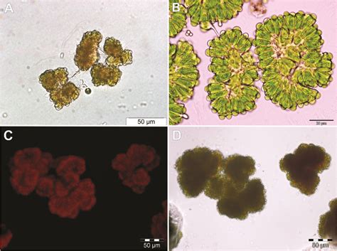 Colonies Of Botryococcus Braunii Connected With Colorless Mucilage A Download Scientific