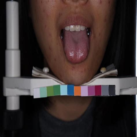 Tongue Detection Object Detection Dataset By Pengfei He