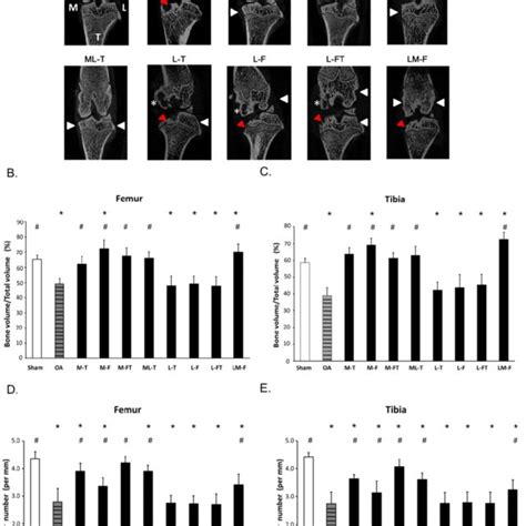 Micro Ct Analysis A Micro Ct Images Illustrated The Positions Of Download Scientific Diagram