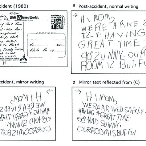 Examples Of Normal And Mirrored Writing By A Woman Following A