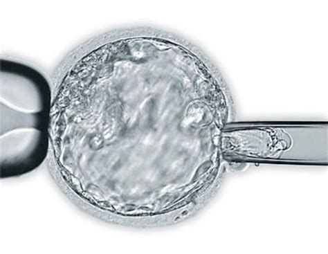 Преімплантаційне генетичне тестування Клініка ЕКЗ та лікування безпліддя академіка Грищенка