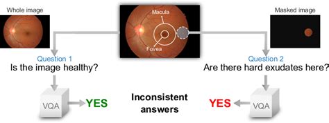 Vqa Inconsistency In Diabetic Macular Edema Staging From Fundus Download Scientific Diagram
