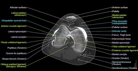 Anatomy Of The Knee Ct Arthrography E Anatomy