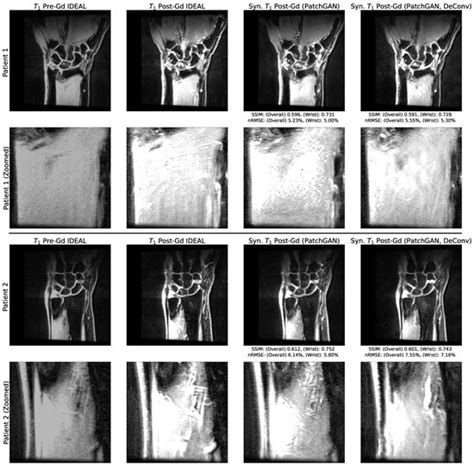 bioengineering free full text synthetic inflammation imaging with