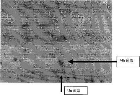 Genitourinary Tract Mycoplasma Culture Medium And Detect Method Thereof Eureka Patsnap