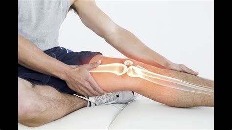 Артрофорс Купить Киев Youtube