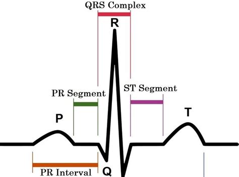 Electrocardiogram