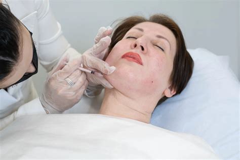 What Are The Risks Or Side Effects Of Pdo Thread Lift